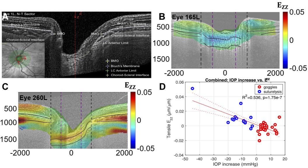Biomechanics of the Optic Nerve Head – Nguyen Lab